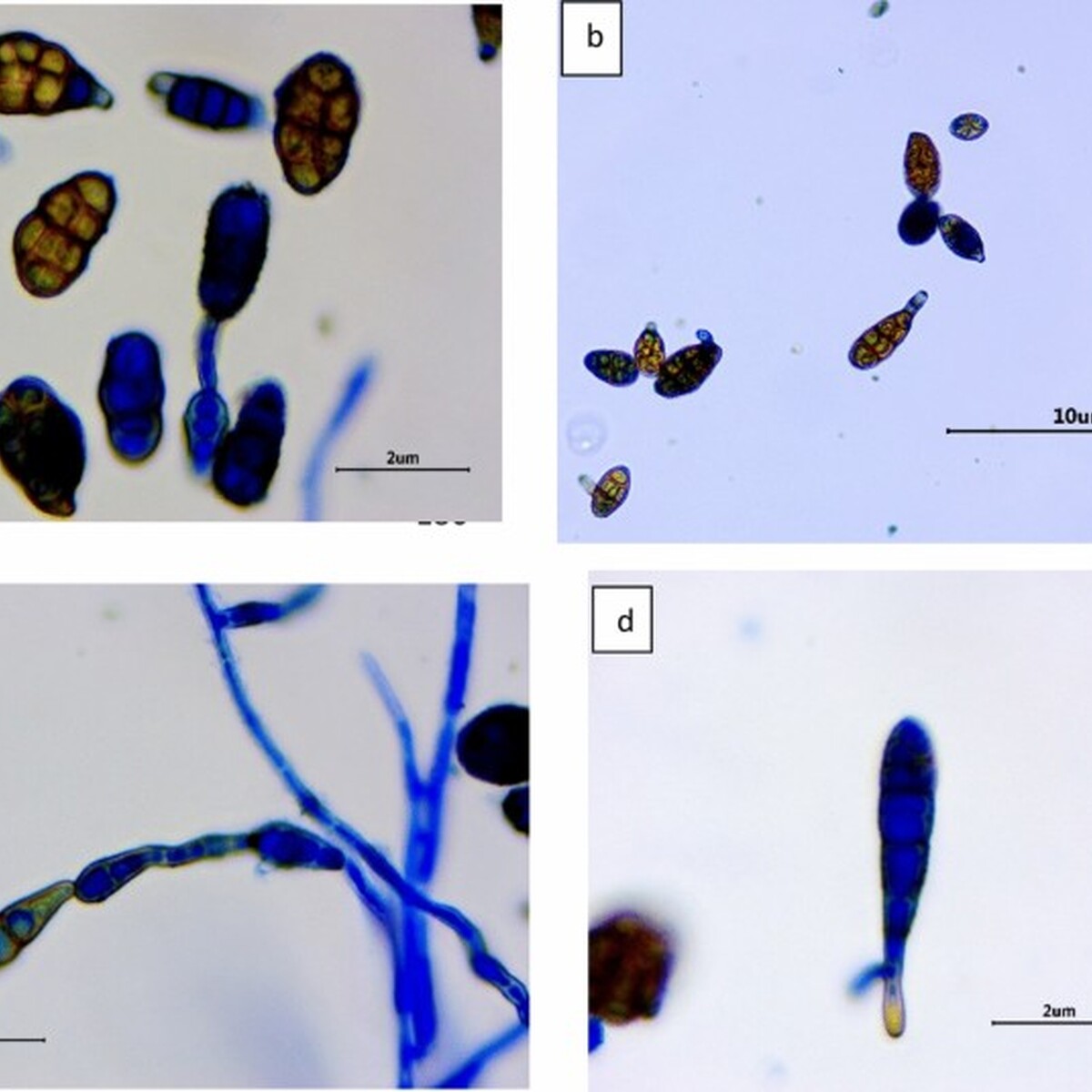 First report of Alternaria aungustiovoidea mediated leaf anomalies in ...