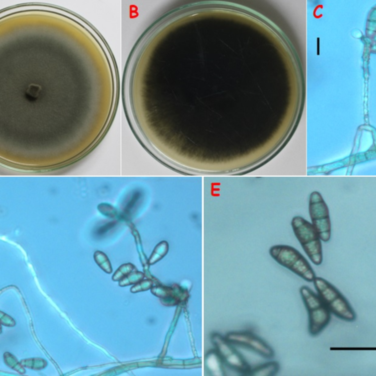 Deciphering the new pinpoint leaf disease in India caused by Curvularia ...