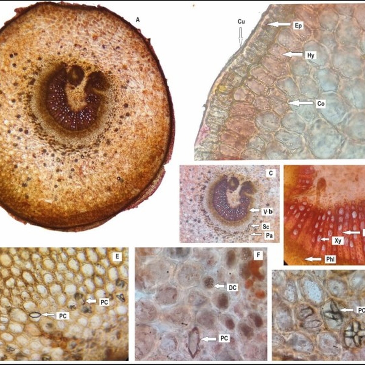Petiole anatomy to delimit taxonomy of genus Glochidion J.R. Forst. & G ...